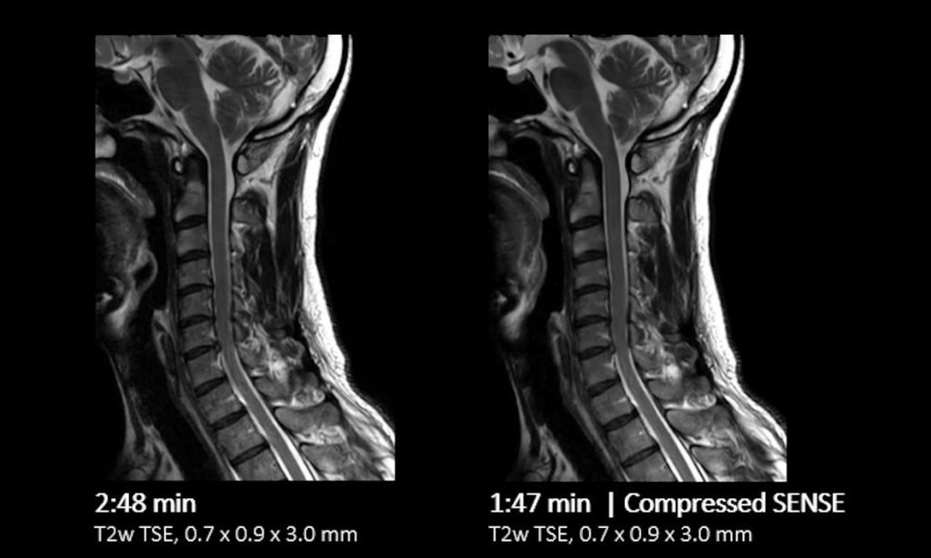 Tufts Ambient Open 3T MRI - Shields