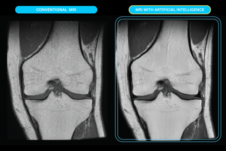 MRI Schedule - Shields