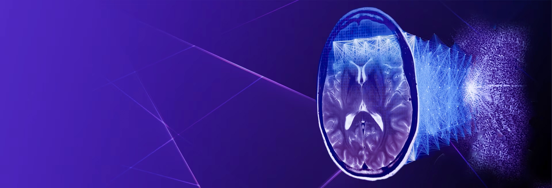 Artificial Intelligence for MRI - Shields